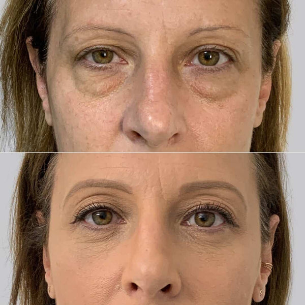 4 raisons d’adopter Lumi Eyes pour un regard plus frais et lumineux ...